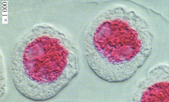 Cellules après coloration de Feulgen