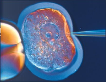 Deux exemples de transgénèse utilisant des gènes humains codant pour l ...