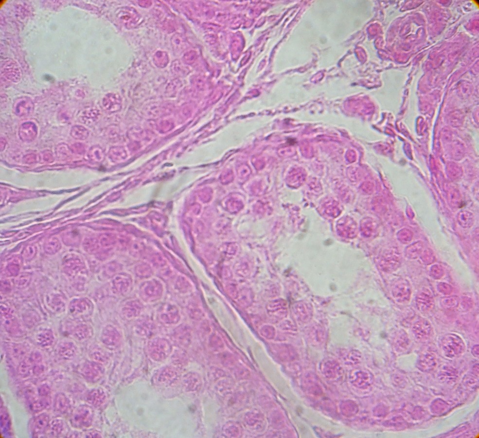Coupes transversales de testicule cryptorchide (colorant : éosine)