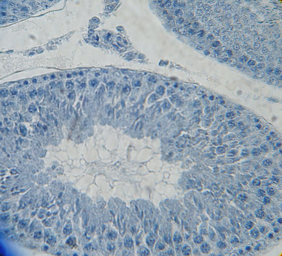 Coupes transversales de testicule cryptorchide (colorant : éosine)