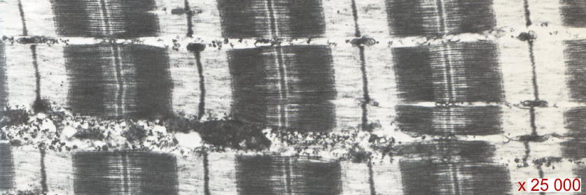 Electronographie d 'un coupe de myofibrille : face
